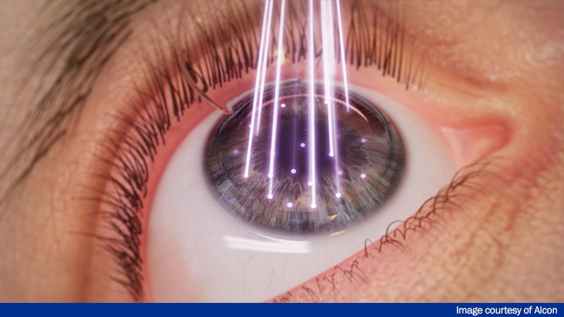 Training at the Tip of the Spear: The Evolution of Alcon’s Digital ...